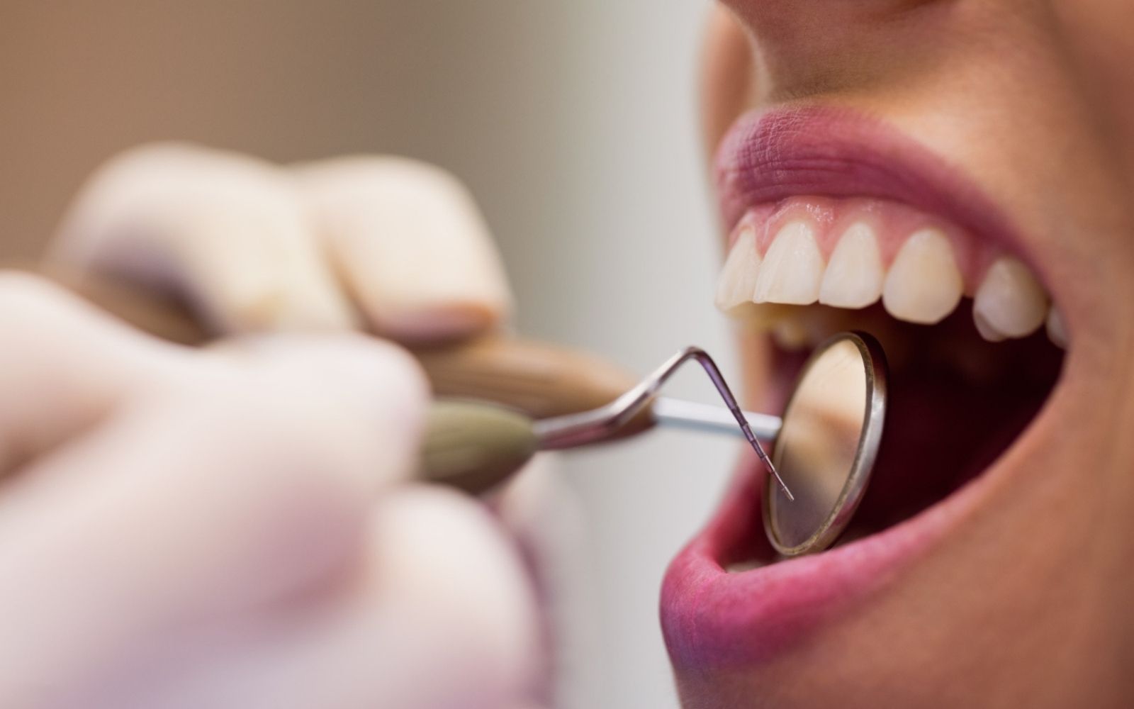 What is composite filling? | Atlas University Hospital