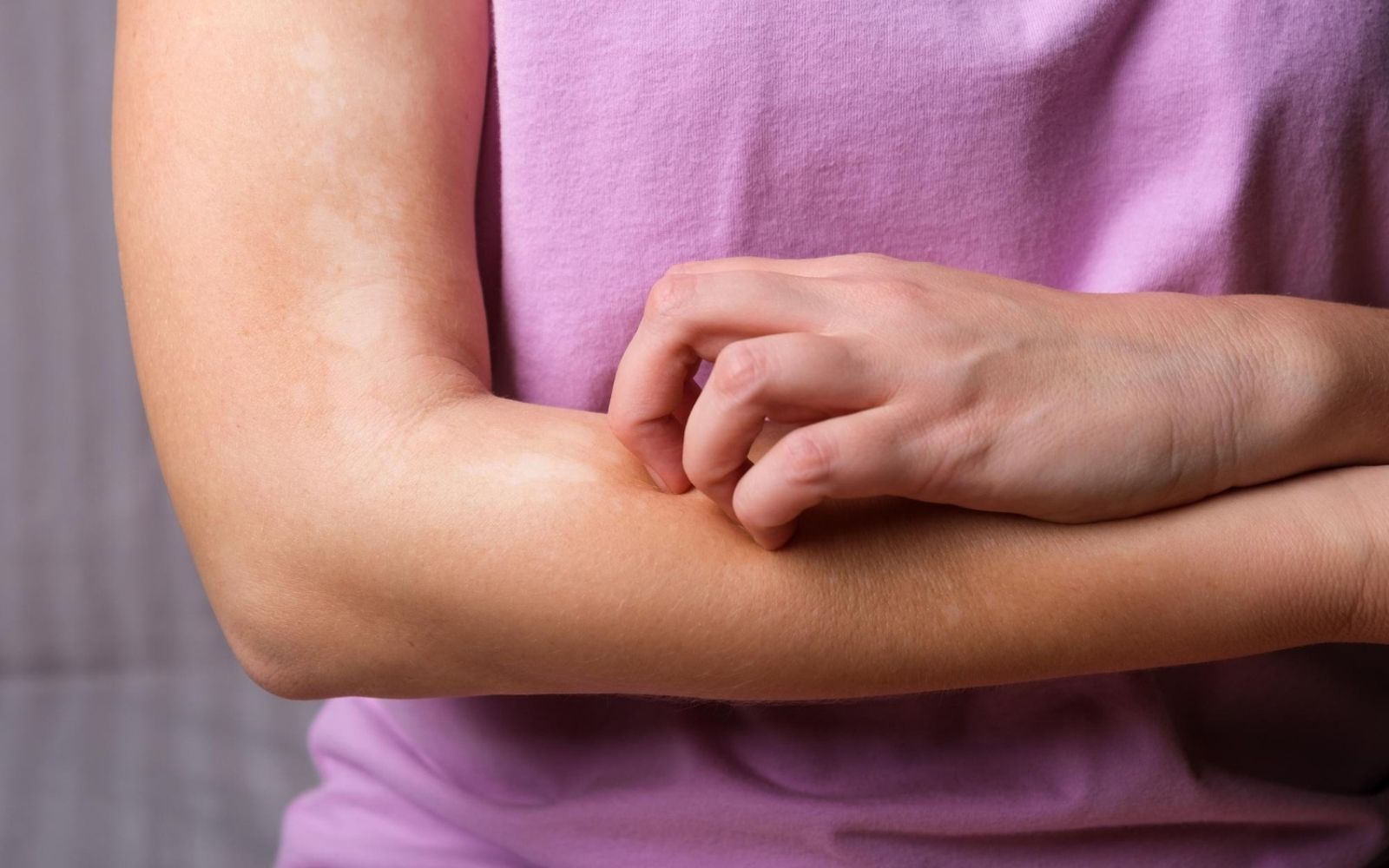 Lichen Simplex Chronicus (Neurodermatitis) | Atlas University Hospital